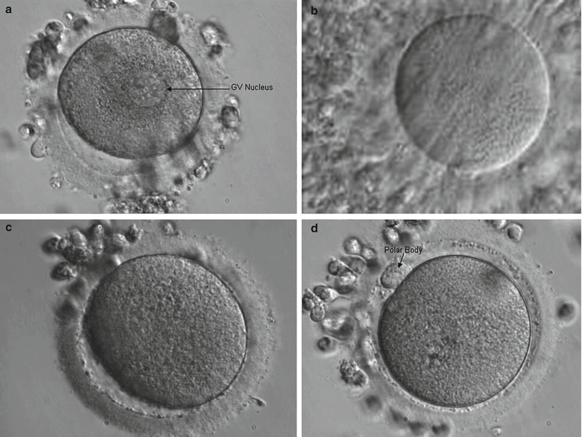 Egg Freezing Overview